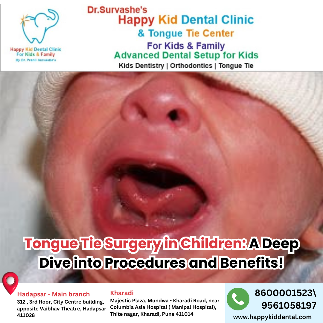 Tongue Tie Surgery in Children: A Deep Dive into Procedures and ...