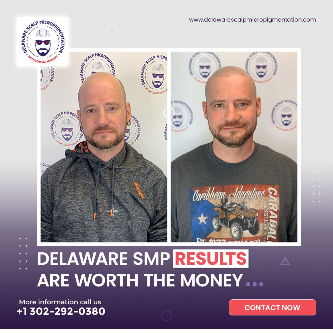DELAWARE SMP RESULTS ARE WORTH THE MONEY | by Delaware Scalp ...
