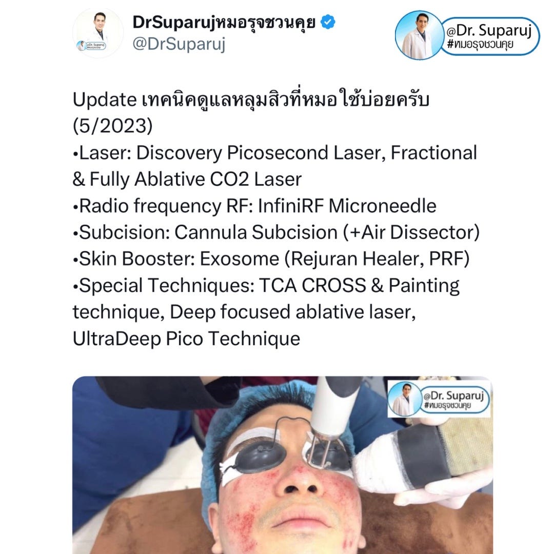 📍Update Acne Scar Treatment Techniques. (5/2023) - Dr. Suparuj หมอรุจชวนคุย Acne Scar Treatment ...