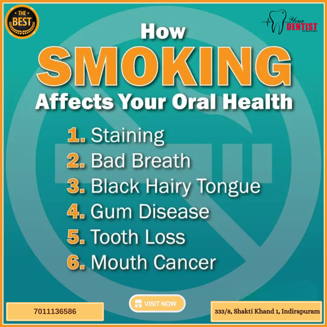 The Impact of Smoking on Your Dental Health | by Your Dentist (Dr ...