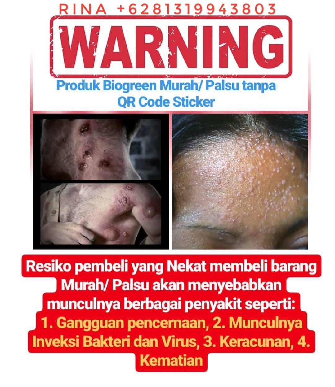 WASPADA PRODUK BIOGREEN APPLE STEM CELL PALSU DENGAN HARGA MURAH | by ...