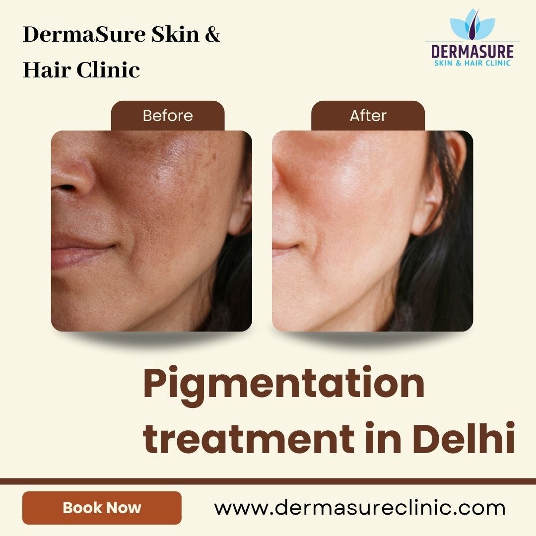 Effective Pigmentation Treatment in Delhi | Dermasure Clinic - DermaSure Skin & Hair Clinic - Medium