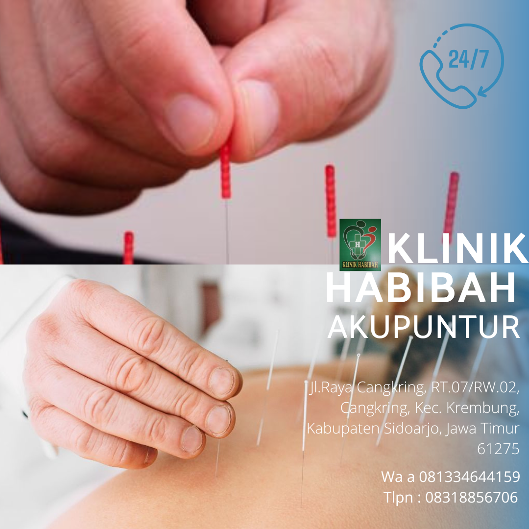 FASILITAS LENGKAP , wa 6281-3346-4419,Terapi Akupunktur Klinik Habibah ...
