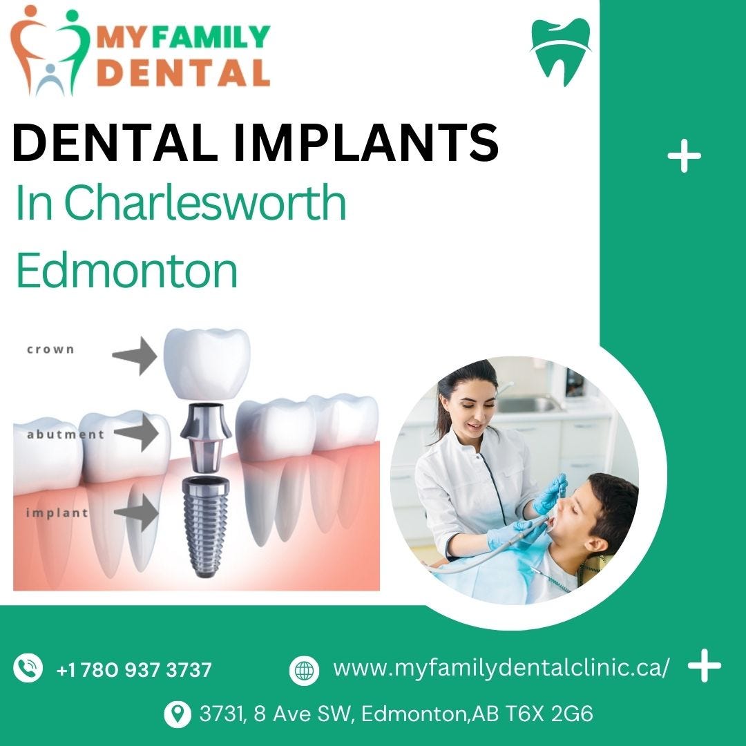 Dental Implants in Charlesworth Edmonton — My Family Dental - Myfamilydentaledmonton - Medium
