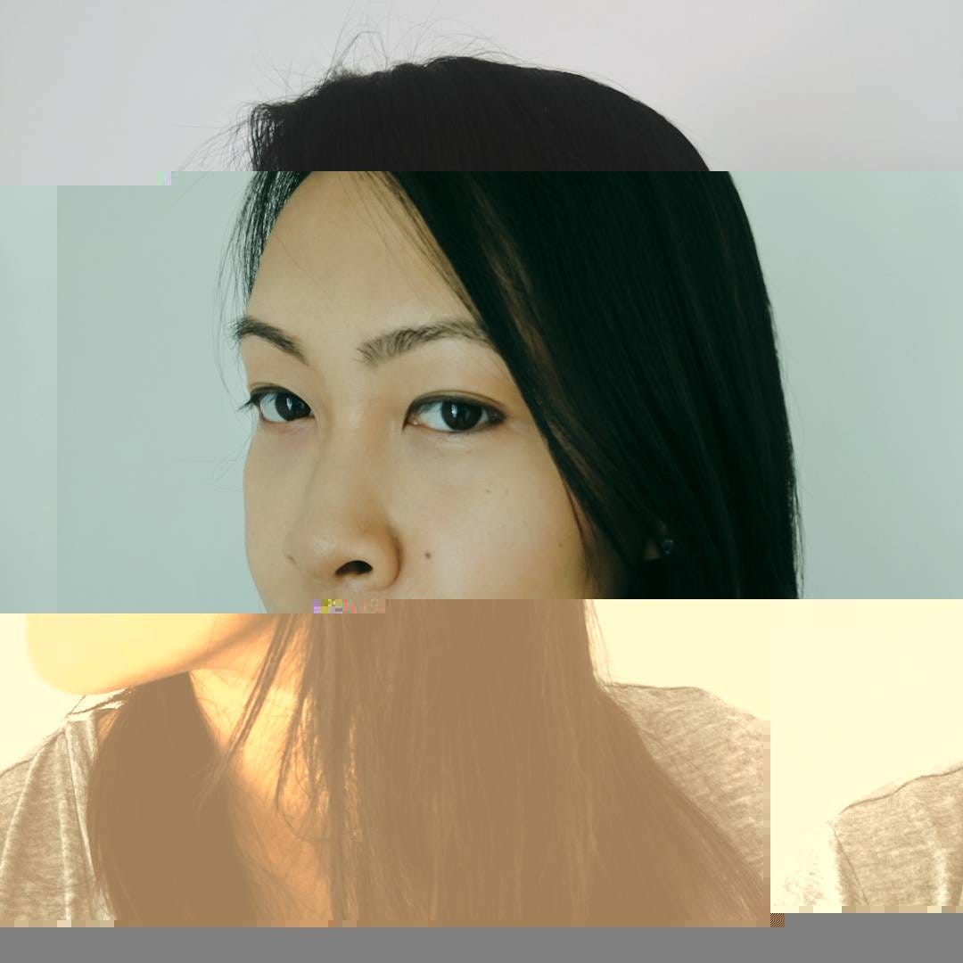 Underbite Side View