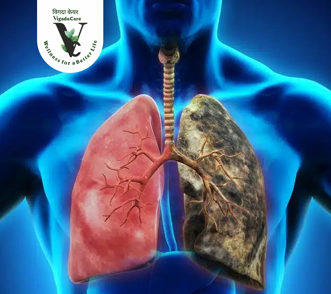 How Can I Keep My Respiratory System Healthy? | by Vigada Care | Medium