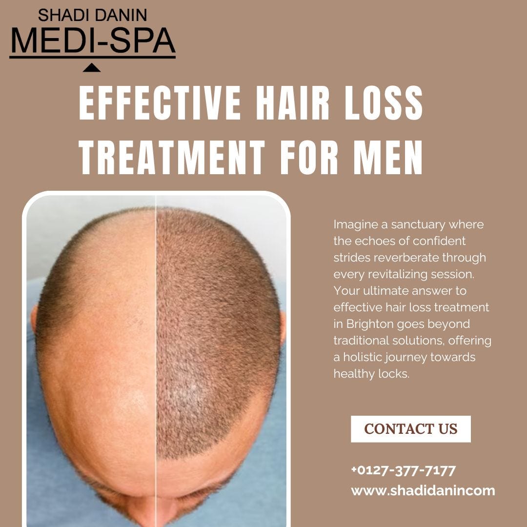 The Ultimate Guide To Effective Hair Loss Treatment for Men In Brighton ...