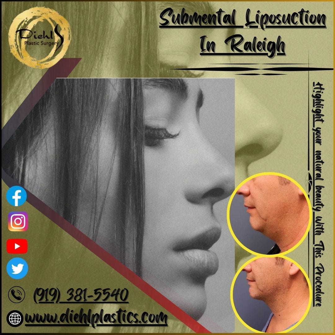 Submental Liposuction In Raleigh Provided By Diehl Plastics Surgery ...