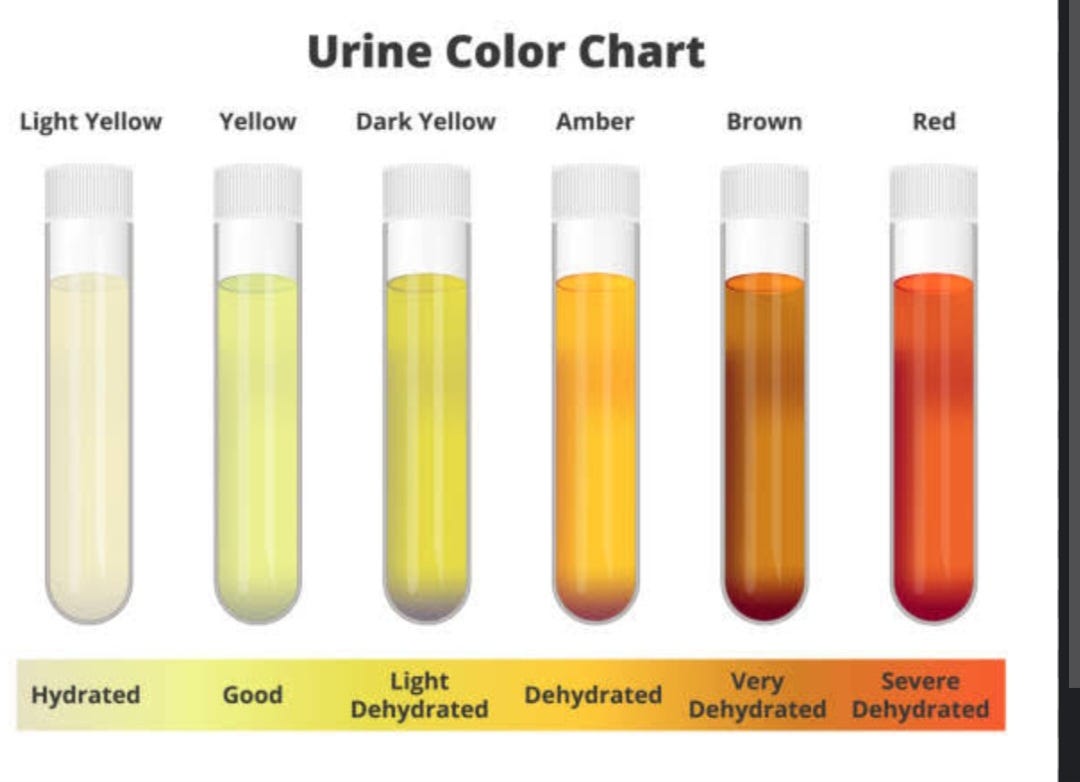 THIS IS WHAT YOUR URINE SAYS ABOUT YOUR HEALTH | by Scientist Gift ...