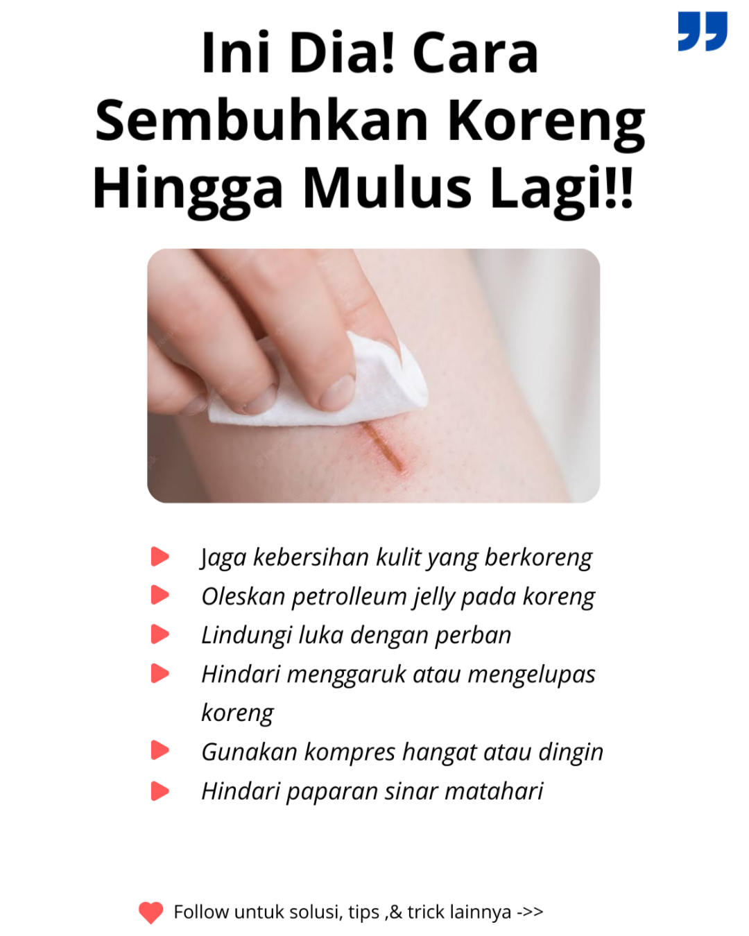 Sembuhkan Luka Koreng Dengan Mulus | by Pak Muh Herbal | Oct, 2023 | Medium