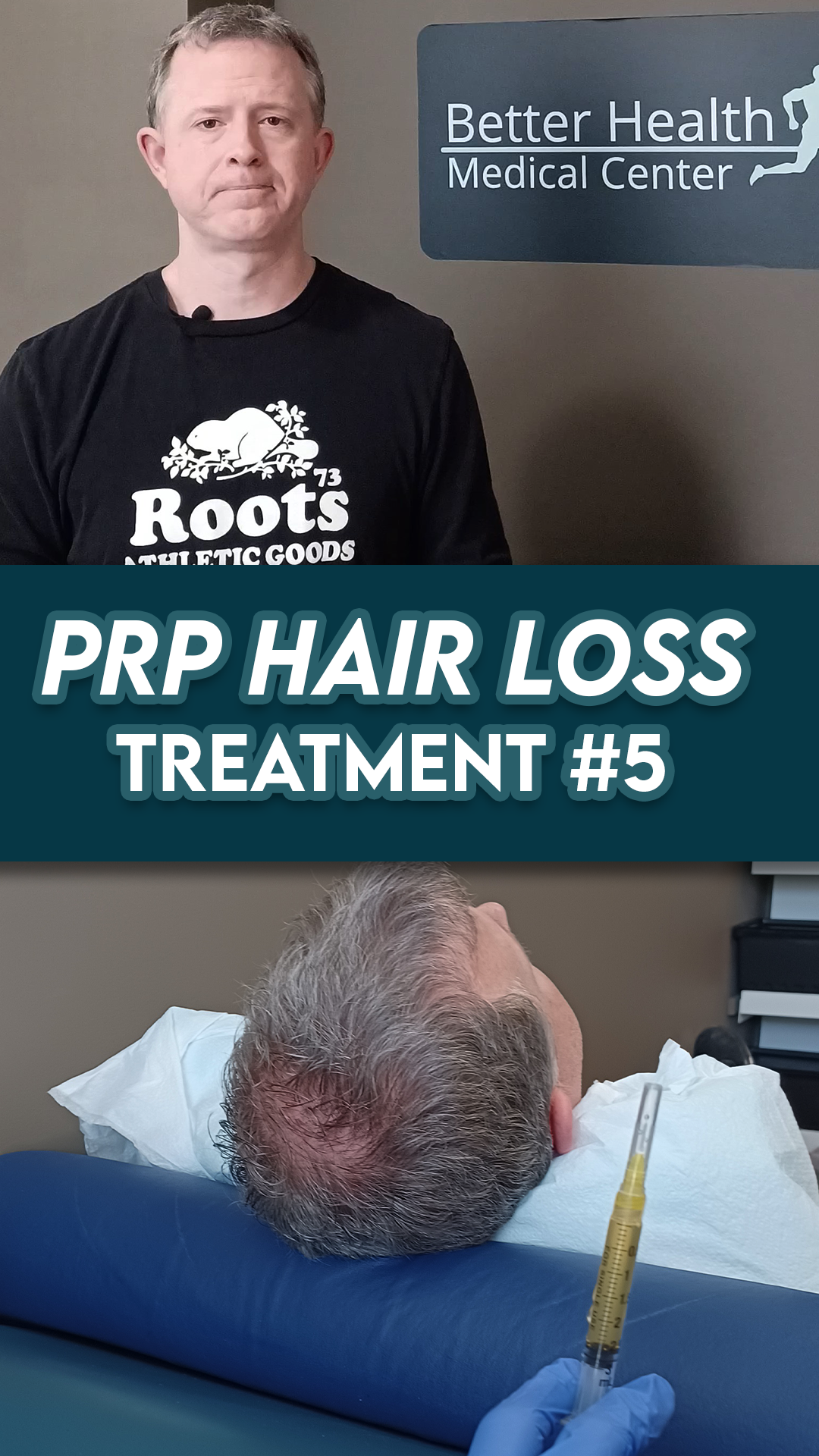Baltimore PRP Therapy for Hair Loss: Session Number 5 | by Better ...