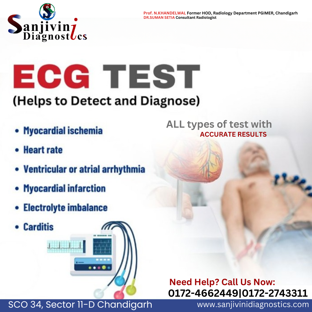 Sanjivini Diagnostics: Your Go-To ECG Testing Lab in Chandigarh ...