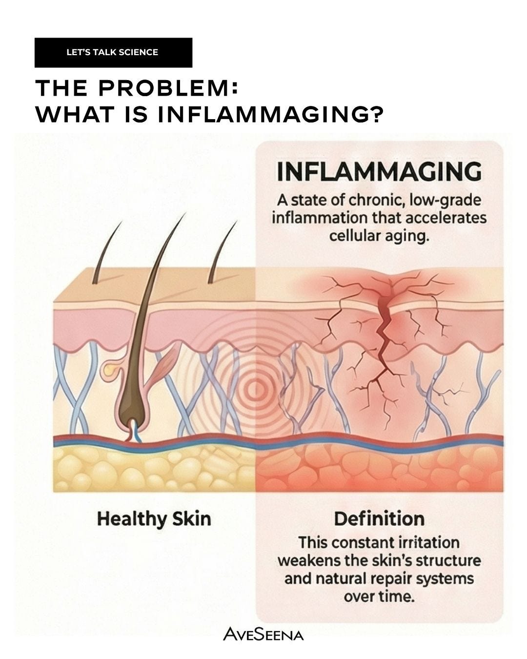 What Is Inflammaging? An Immunologist Explains What’s Happening to Your ...