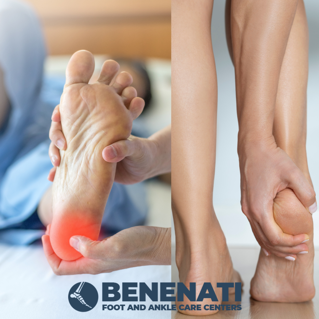 Heel Pain, Treatment, and Causes. Introduction | by Mike Cartell | Medium