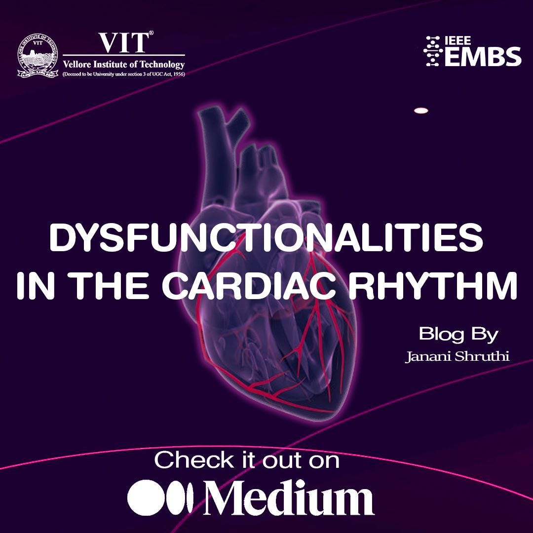 DYSFUNCTIONALITIES IN THE CARDIAC RHYTHM | by Jananishruthi ...
