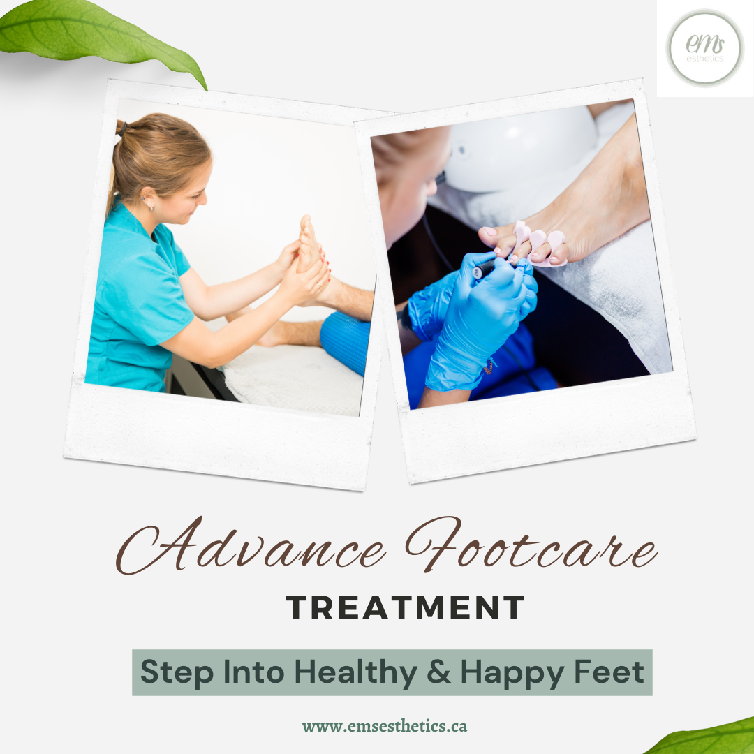 Pamper Your Feet with Advance Footcare Treatment in Vancouver - Emily ...