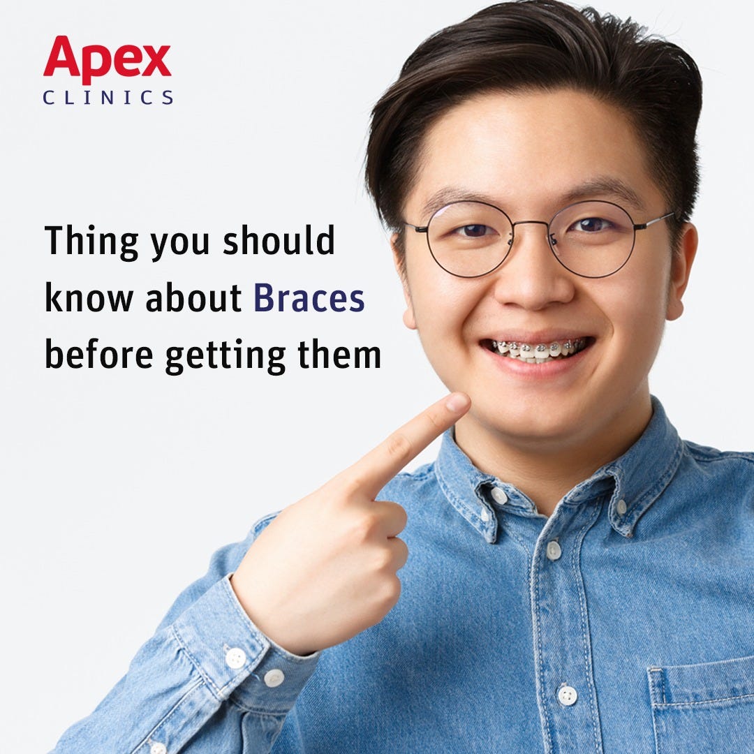 What should you know about Braces before getting them | by Apex Dental ...