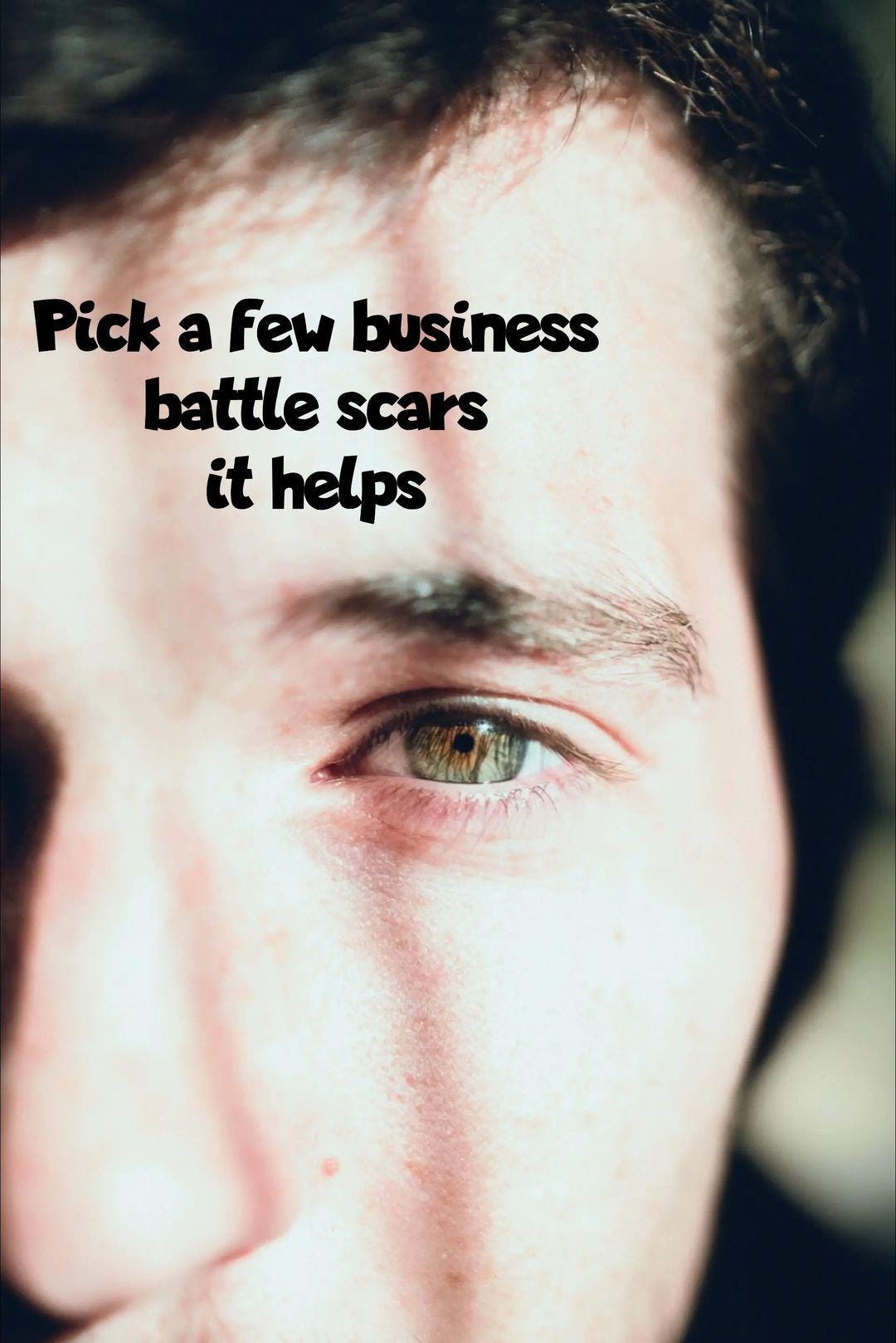 Battle Scars Quotes