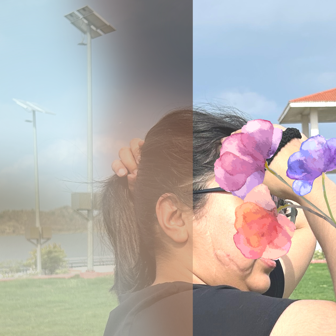 My warrior scar. She would be prettier without the scar | by Muskan ...