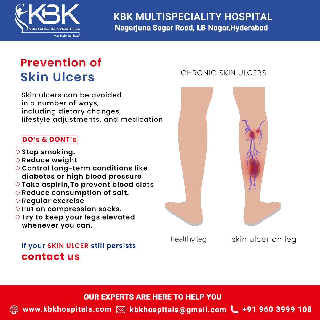 𝑷𝒓𝒆𝒗𝒆𝒏𝒕𝒊𝒐𝒏 𝒐𝒇 𝑺𝒌𝒊𝒏 𝑼𝒍𝒄𝒆𝒓𝒔 - KBK Hospitals - Medium