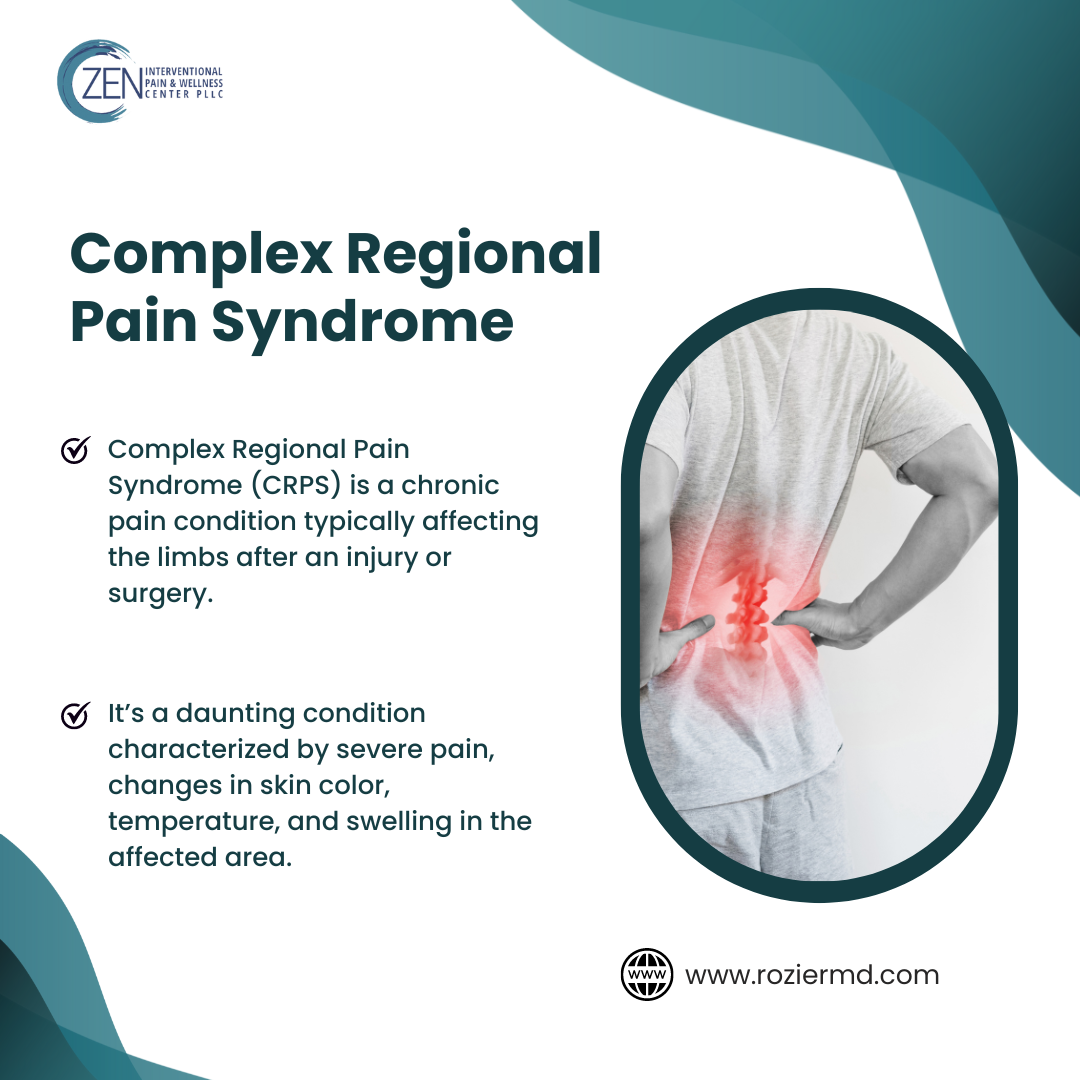 Advanced Pain Management Techniques for Complex Regional Pain Syndrome ...
