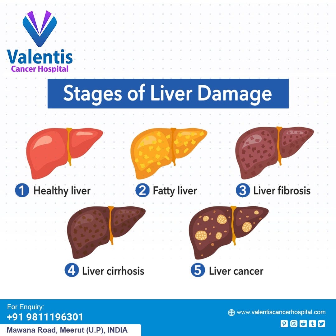 Liver Cancer Symptoms: Recognizing the Signs | by Valentis cyberknife ...