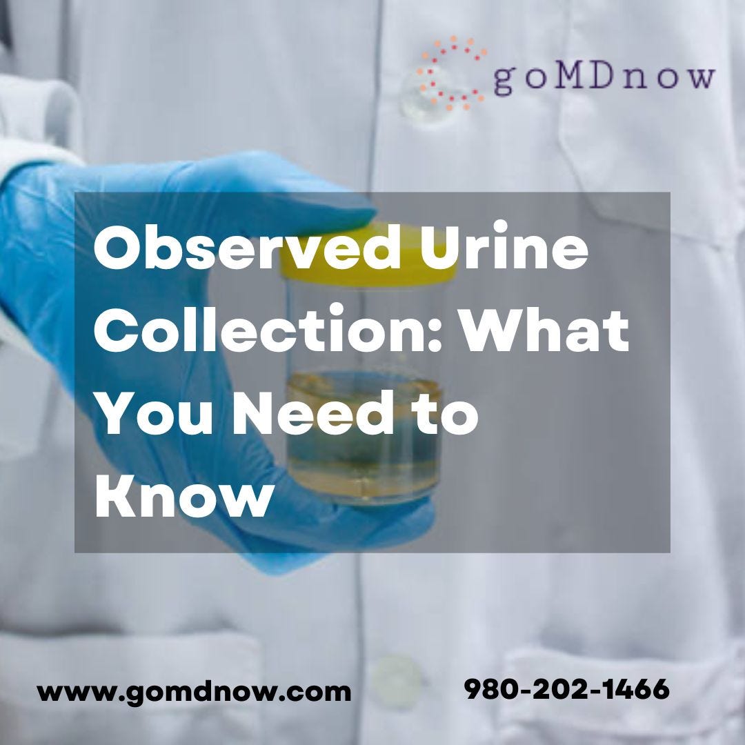 Observed Urine Collection: What You Need to Know | by gomdnow | Medium