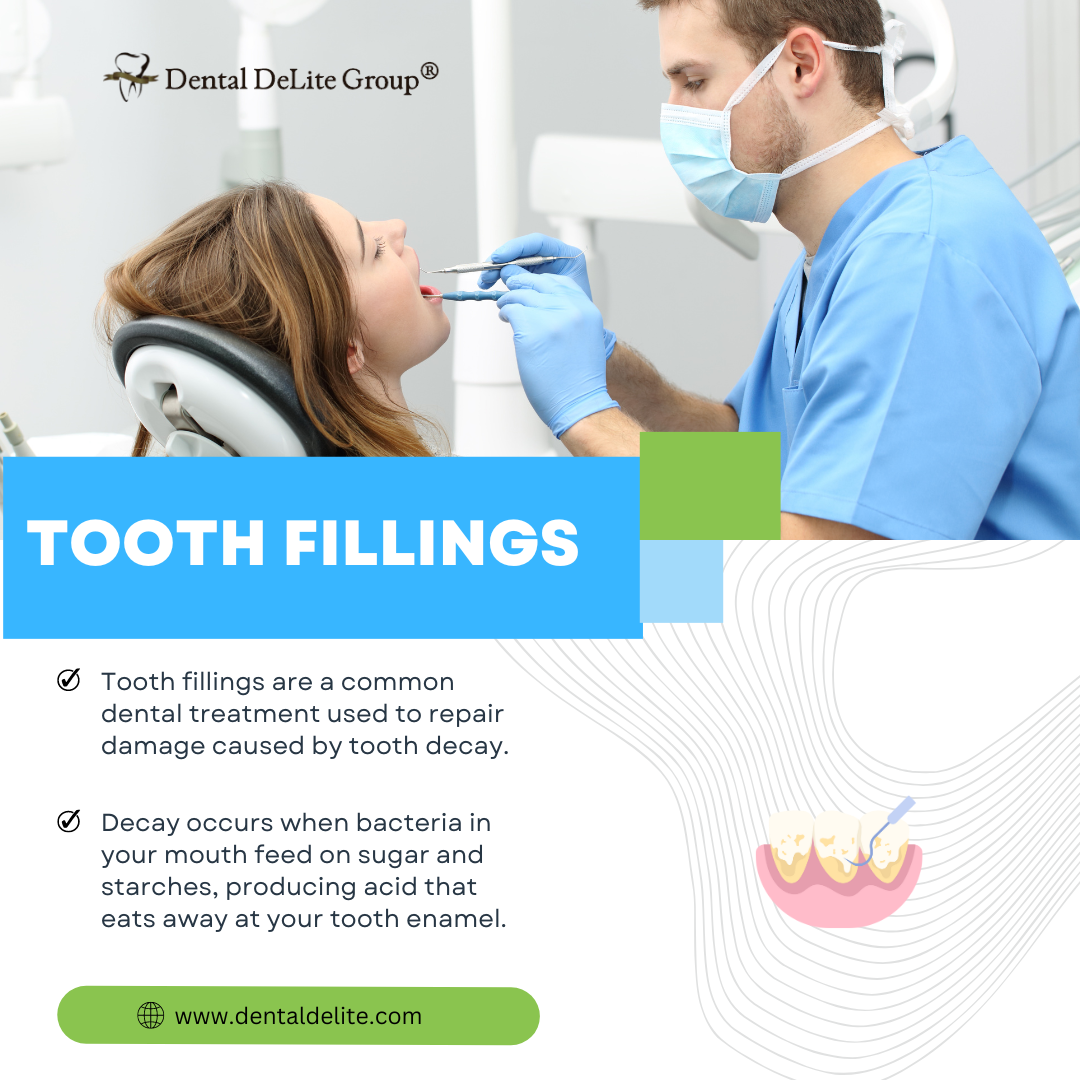 Why Tooth Fillings Are Essential for Your Oral Health in Dallas, TX ...