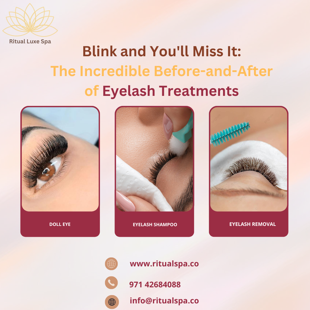 Eyelash Treatments in DubaiBlink and You’ll Miss It: The Incredible ...