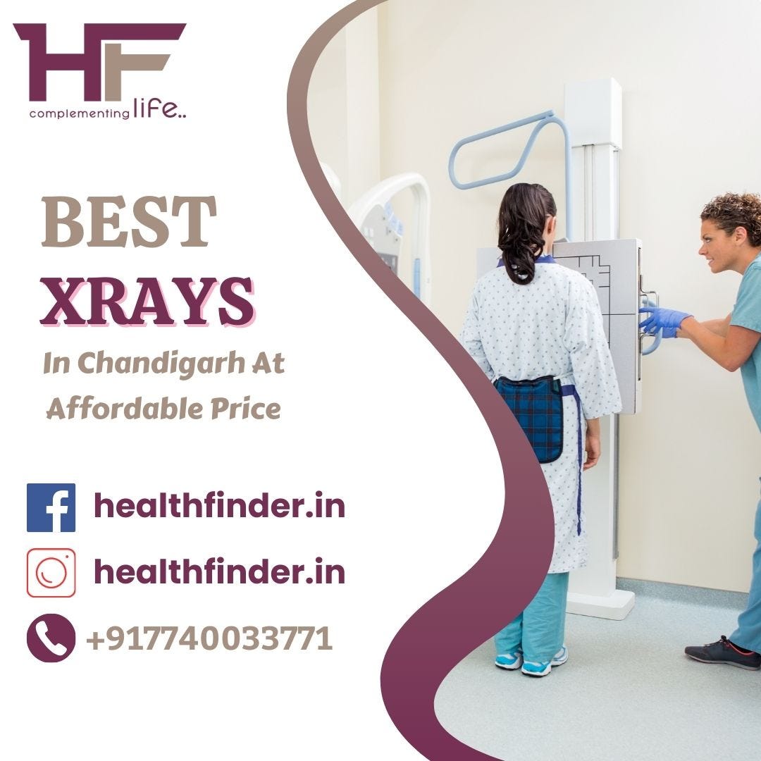 Best Xrays In Chandigarh At Affordable Price | by Alka Tiwari | Jun ...