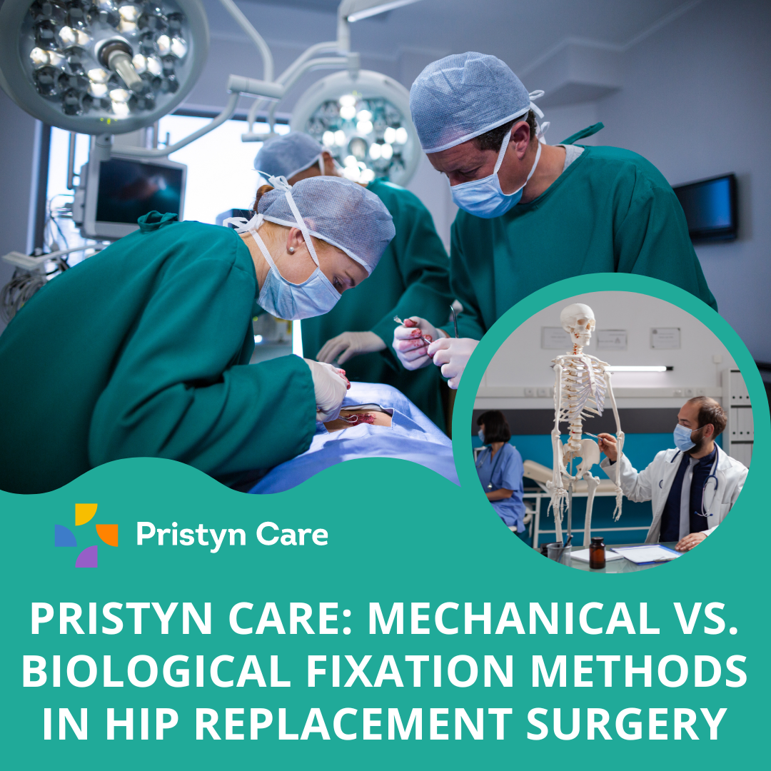 Pristyn Care: Mechanical vs. Biological Fixation Methods in Hip ...