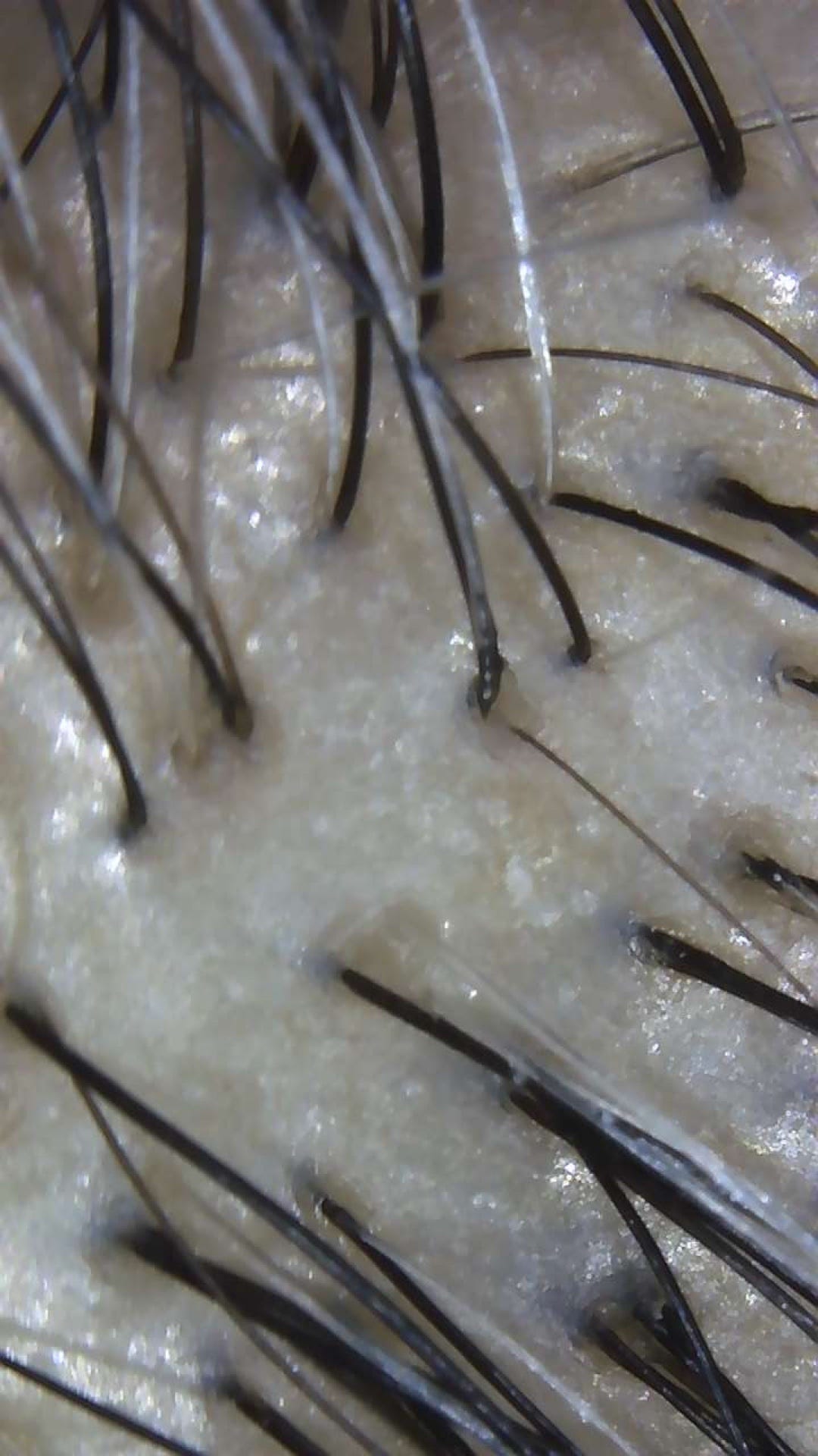 The Scalp Microbiome: Understanding, Care, Pros, and Cons | by ibana ...