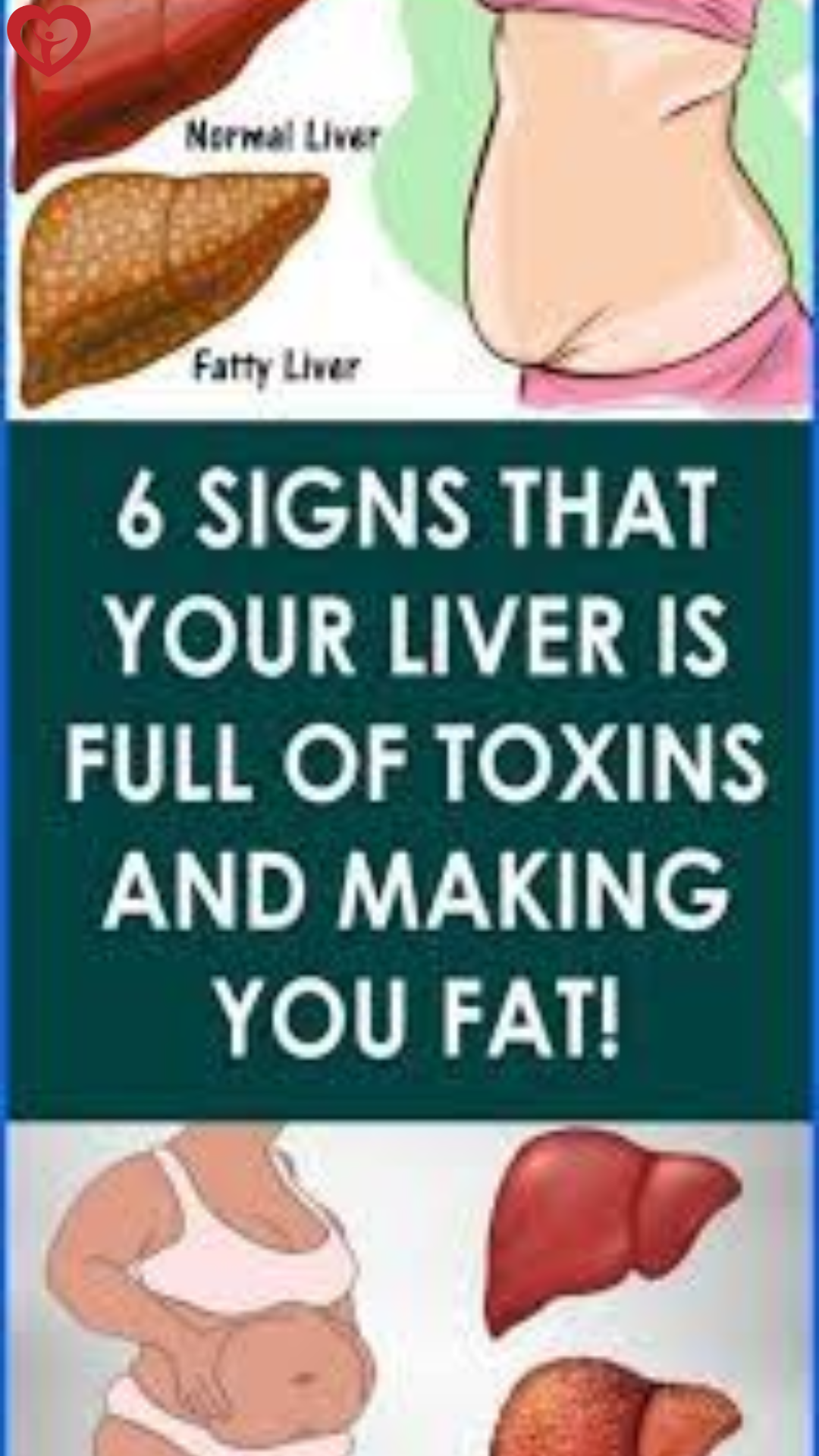 The largest solid organ in the body is the liver and its main function ...