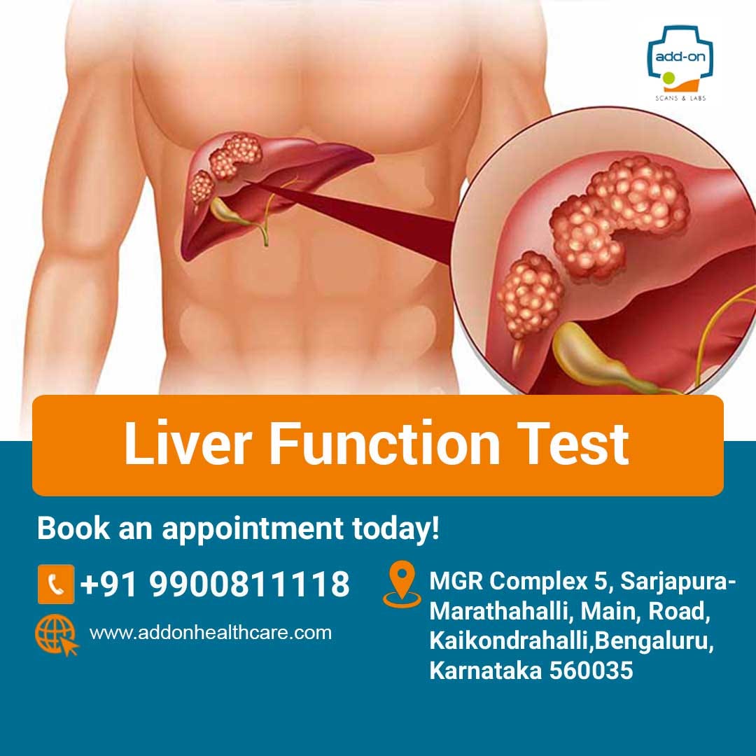 Liver Function test Near Me. Are you in or around Kaikondrahalli… | by ...
