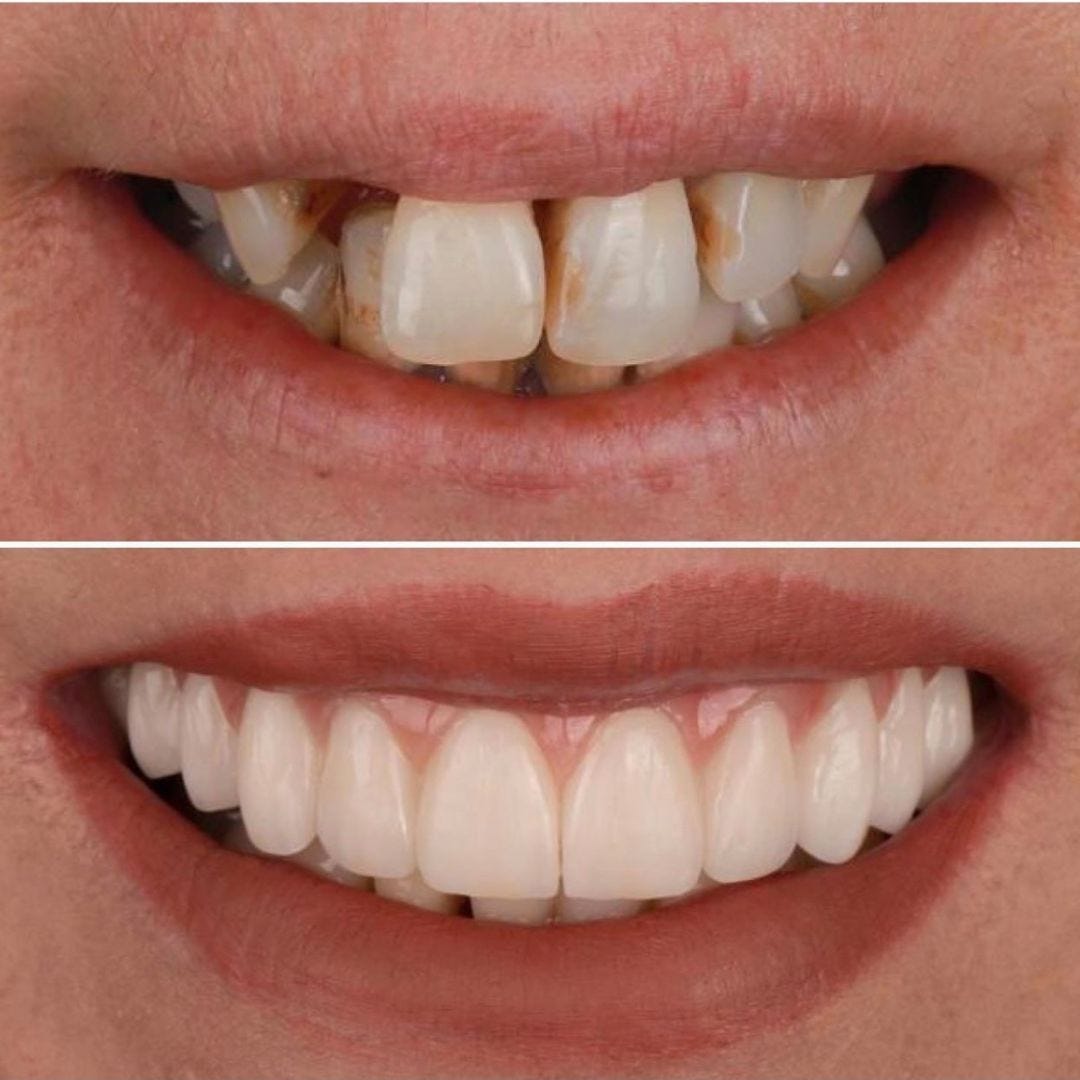Best Dental Implant Specialist Near Charleston, SC - Hehr Oral ...