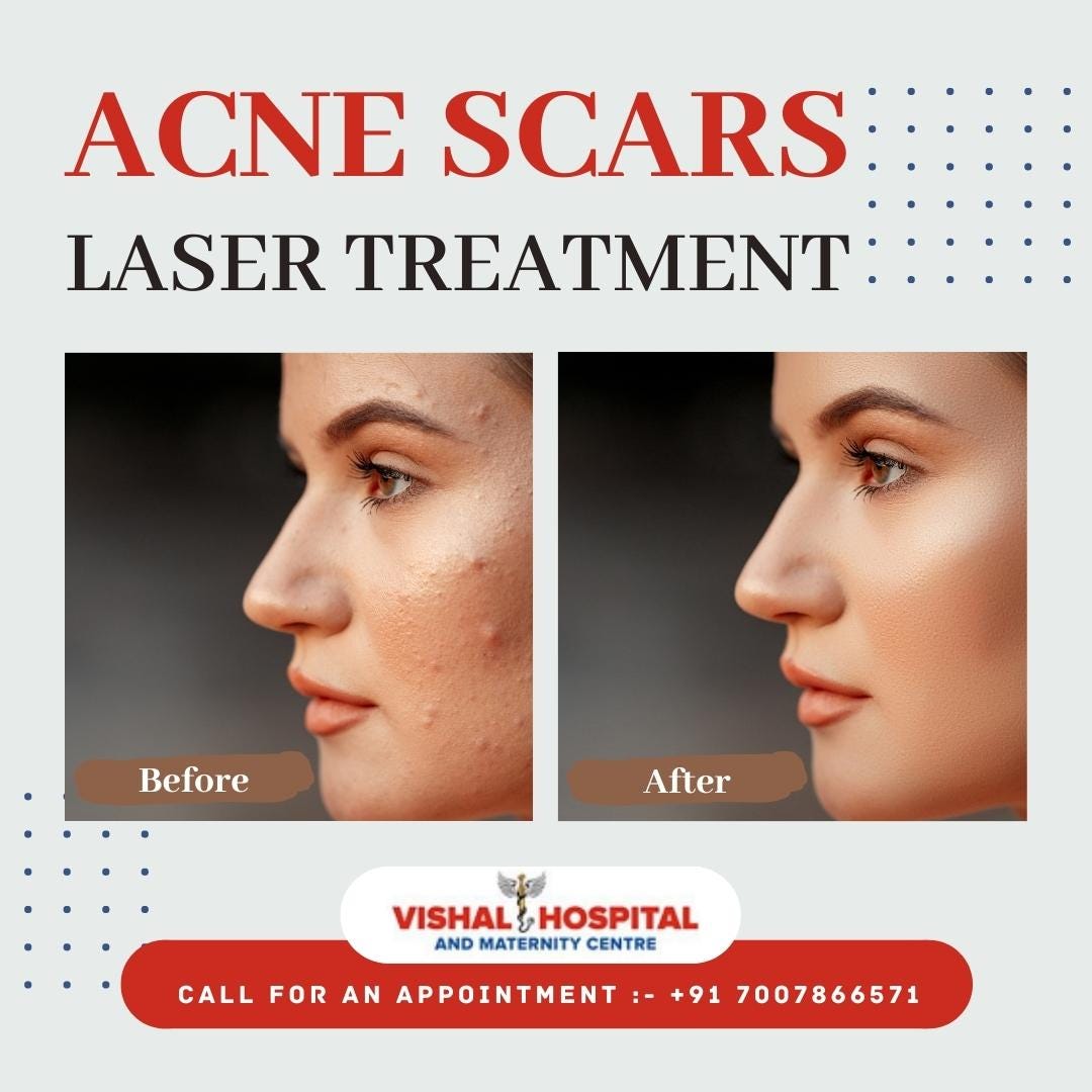 Vishal Hospital — What kind of laser procedure remove acne scars? | by ...