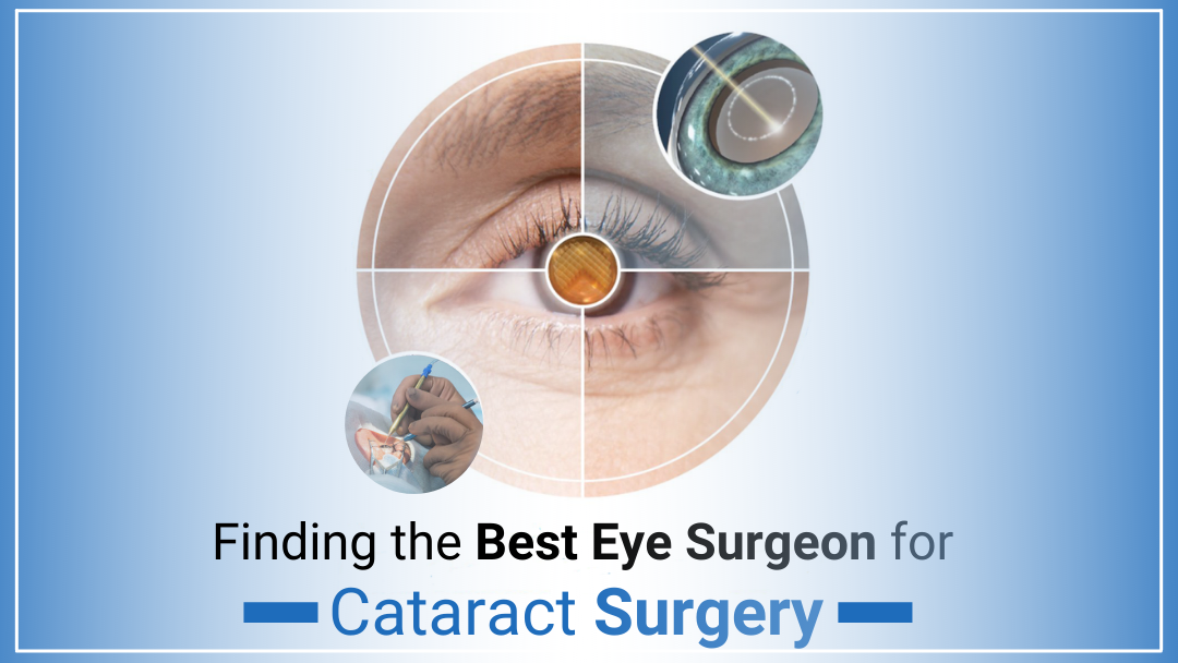 Finding the Best Eye Surgeon for Cataract Surgery | by Dr. Tejesh A ...