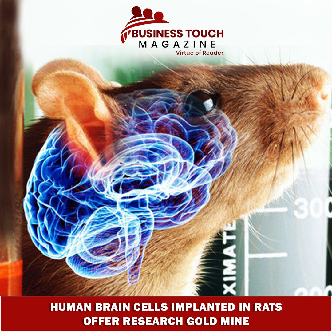 Human Brain Cells Implanted in Rats Offer Research Gold Mine ...