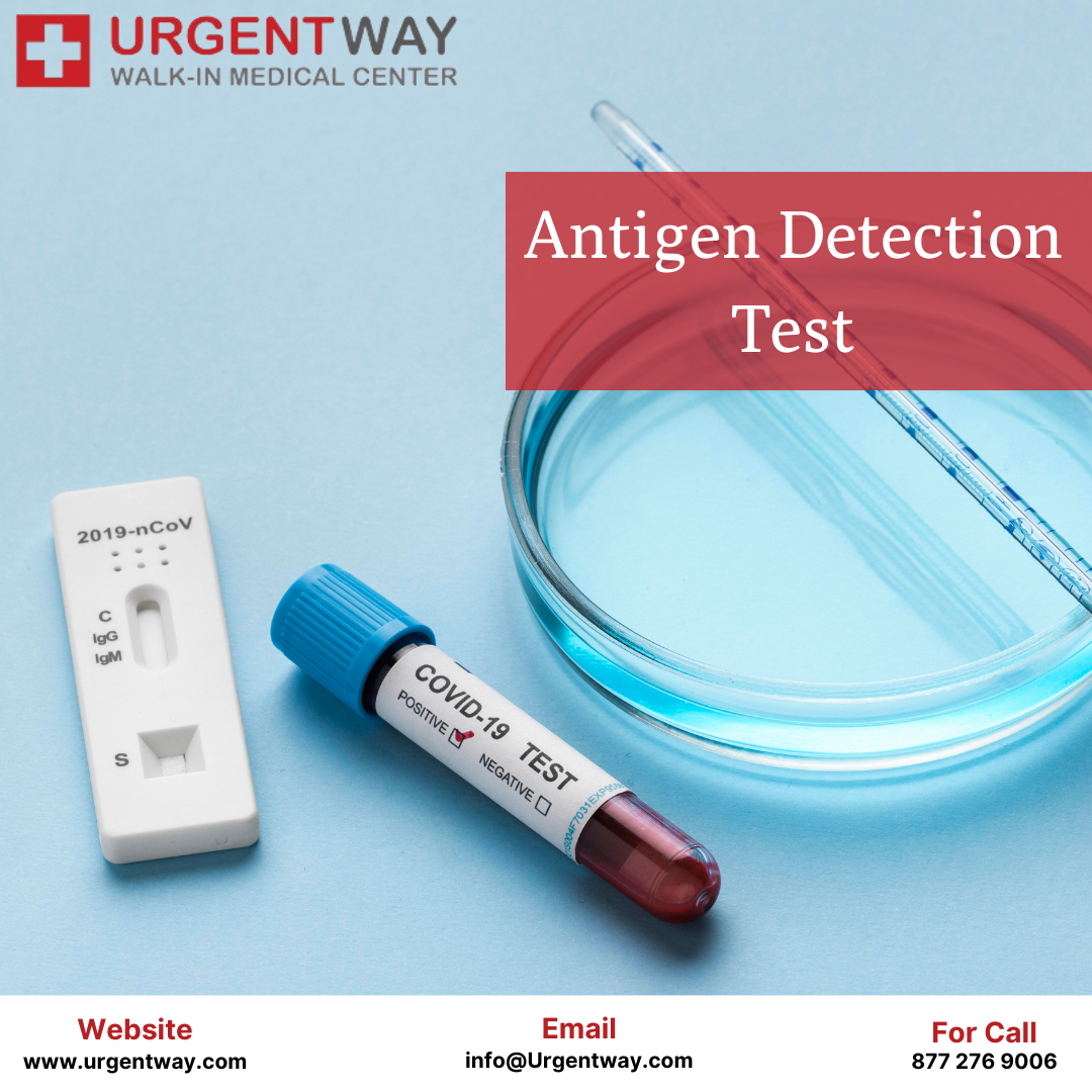 How Antigen Screening Tests are Revolutionizing Disease Detection | by ...