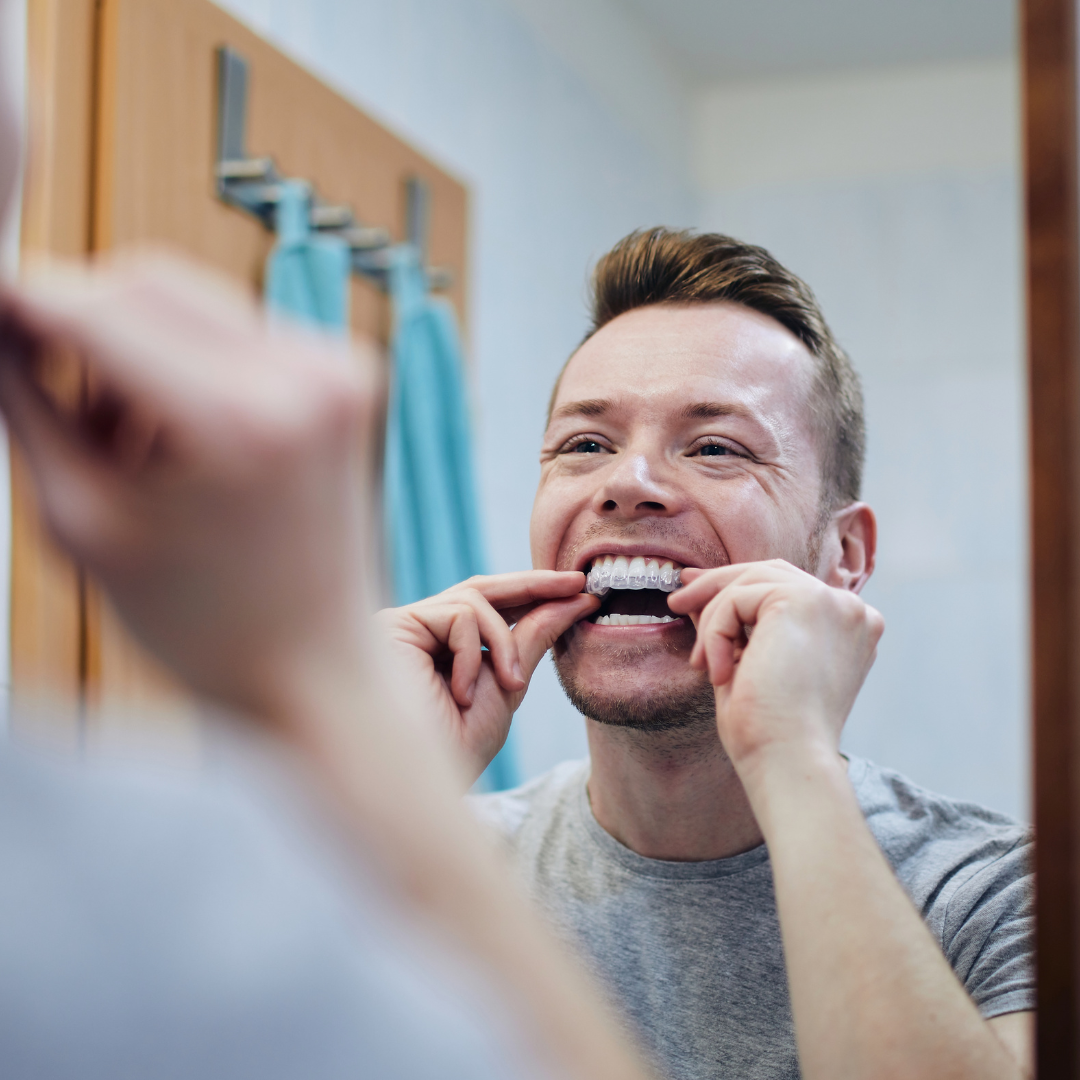 Things You Should Know About Invisalign | by King Street Dental | Medium