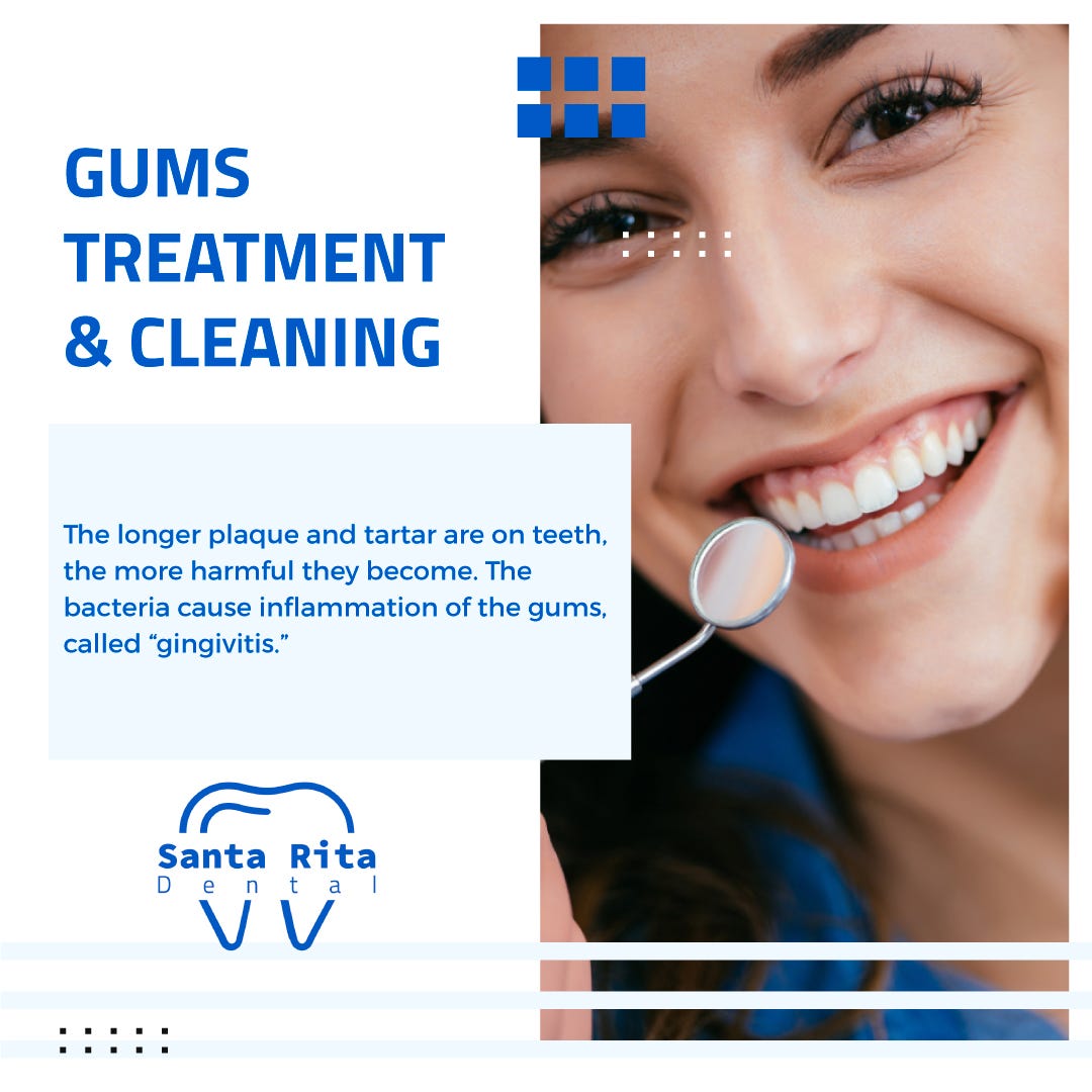 Gums Treatment & Cleaning - Santa Rita Dental - Medium