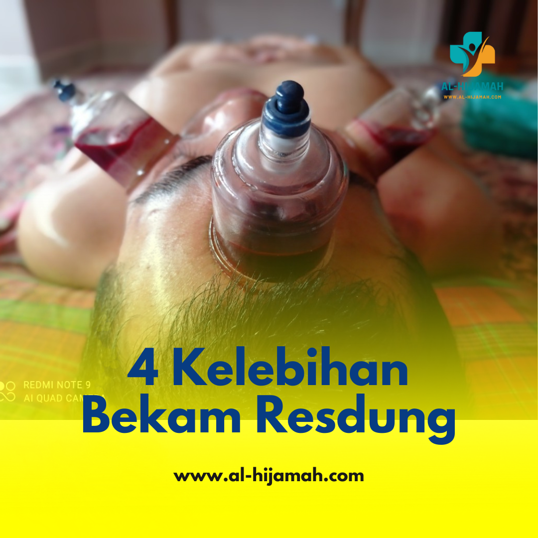 4 Kelebihan Bekam Resdung. Bekam resdung, juga dikenali sebagai… | by al hijamah | Jul, 2024 ...