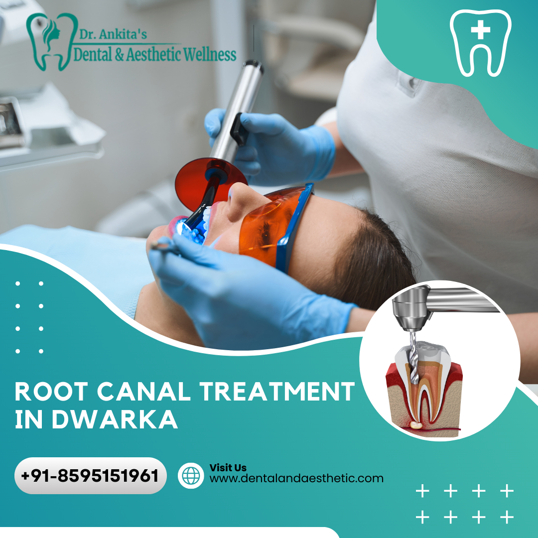 Common Myths About Root Canals: Separating Fact from Fiction | by Sheetal Gupta | Medium