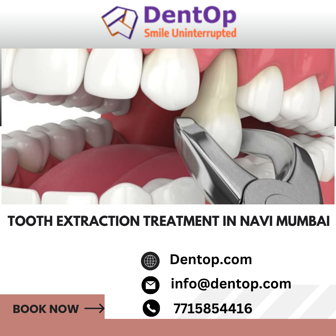 The Best Tooth Extraction Treatment in Navi Mumbai at DentOp - Dentop ...