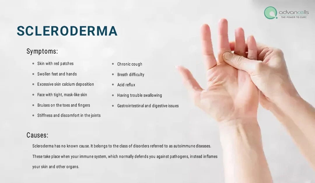 Unraveling The Enigma Of Scleroderma Understanding Its Causes Symptoms And Treatment