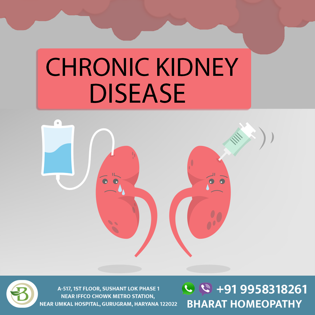 Kidney Treatment by Homeopathy: A Comprehensive Approach to Optimal ...
