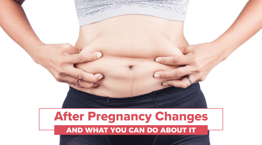Post Pregnancy Changes and What You Can Do About It | by Babygogo ...