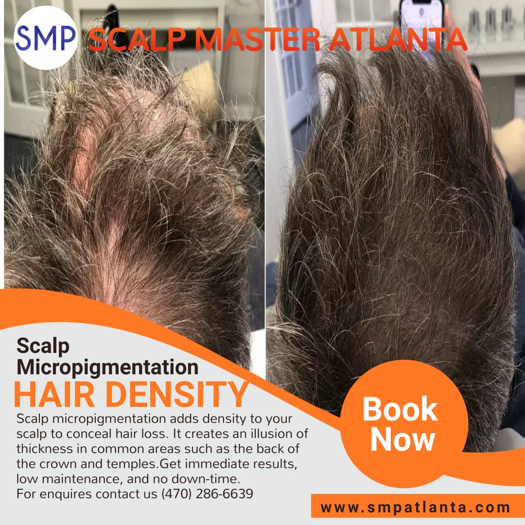 Enhancing Hair Density with Scalp Micropigmentation — The Revolutionary ...