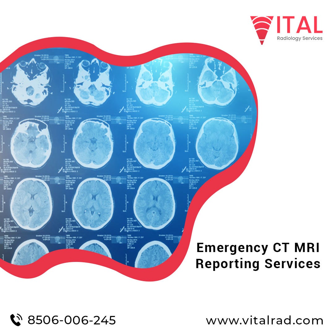 Emergency CT MRI Reporting Services - Vitalradindia - Medium