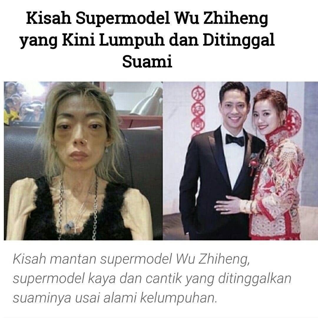 Kisah Tragis super model Wanita cantik Wu Zhiheng yang kini cacat ditinggalkan sang suami | by ...